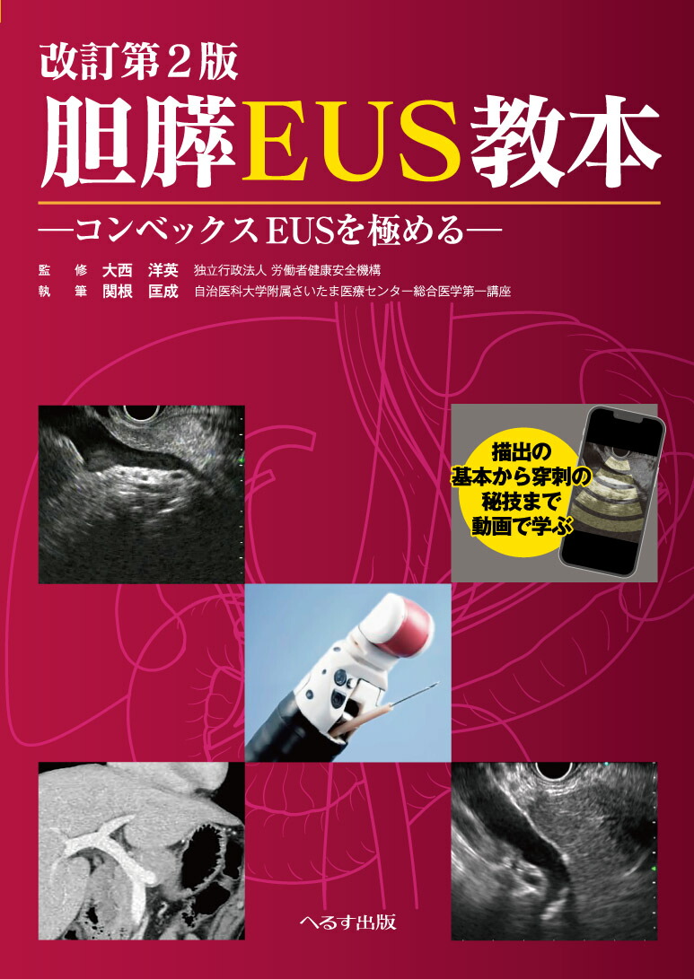 楽天ブックス: 改訂第2版 胆膵EUS教本 - コンベックスEUSを極める 描出の基本から穿刺の秘技まで動画で学ぶ - 大西 洋英 ...