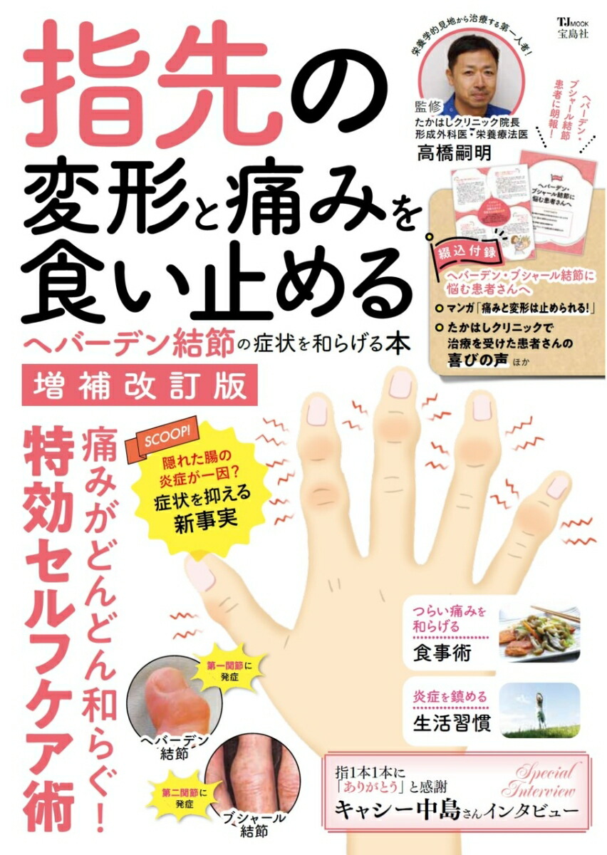 楽天ブックス 指先の変形と痛みを食い止める ヘバーデン結節の症状を和らげる本 増補改訂版 高橋 嗣明 9784299041876 本