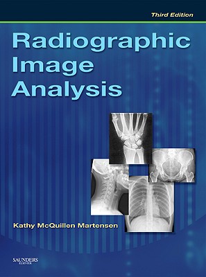 楽天ブックス: Radiographic Image Analysis - Kathy McQuillen Martensen ...