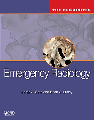 楽天ブックス: Emergency Radiology - Jorge A. Soto - 9780323054072 : 洋書