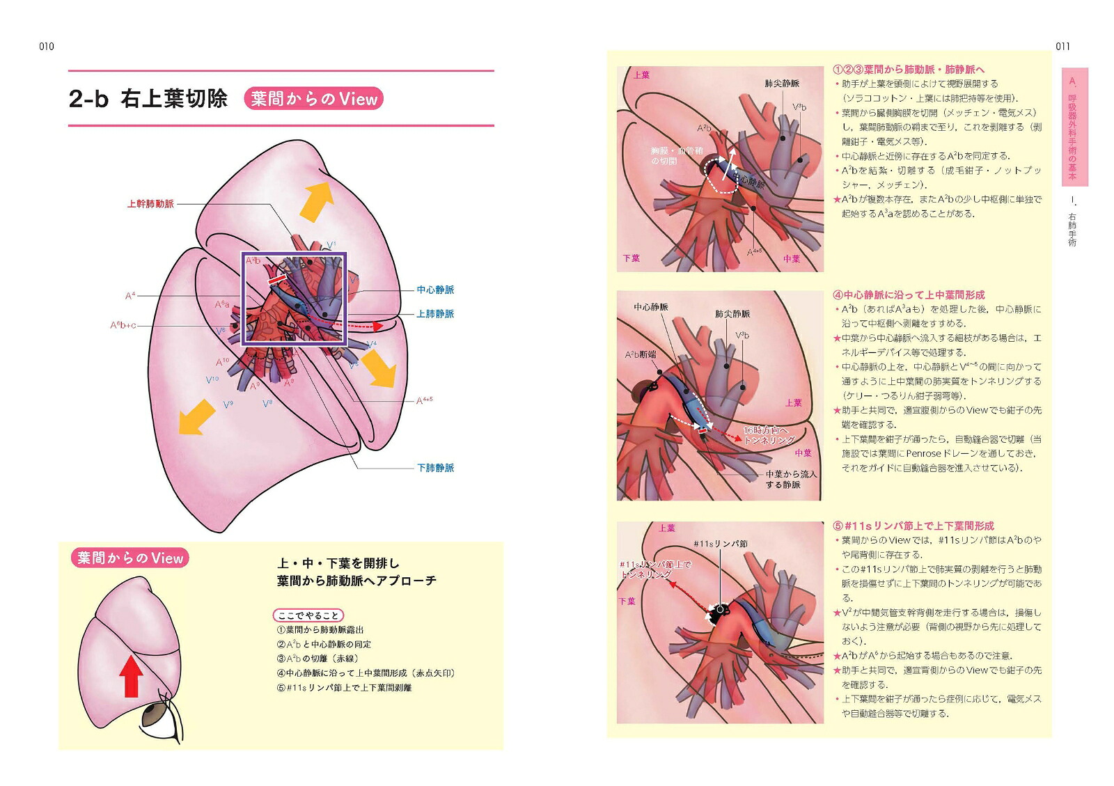楽天ブックス ベクトル視点でやさしく読み解く呼吸器外科手術解剖イラスト 安部美幸 9784524204151 本
