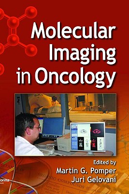 楽天ブックス: Molecular Imaging in Oncology - Martin G. Pomper ...
