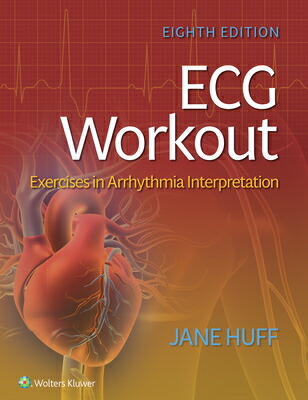 楽天ブックス: ECG Workout: Exercises in Arrhythmia Interpretation - Loreda J ...