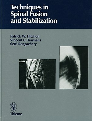 楽天ブックス: Techniques in Spinal Fusion and Stabilization: - Patrick W ...