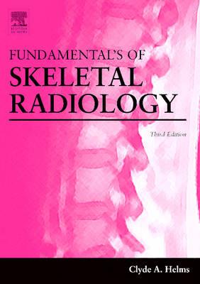 楽天ブックス: Fund of Skeletal Radiology 3e - Clyde A. Helms - 9780721605708 : 洋書