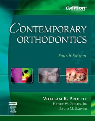 楽天ブックス: Contemporary Orthodontics E-Dition: Text with Continually ...