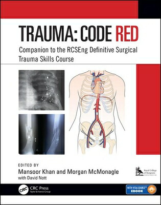楽天ブックス: Trauma: Code Red: Companion to the Rcseng Definitive Surgical ...