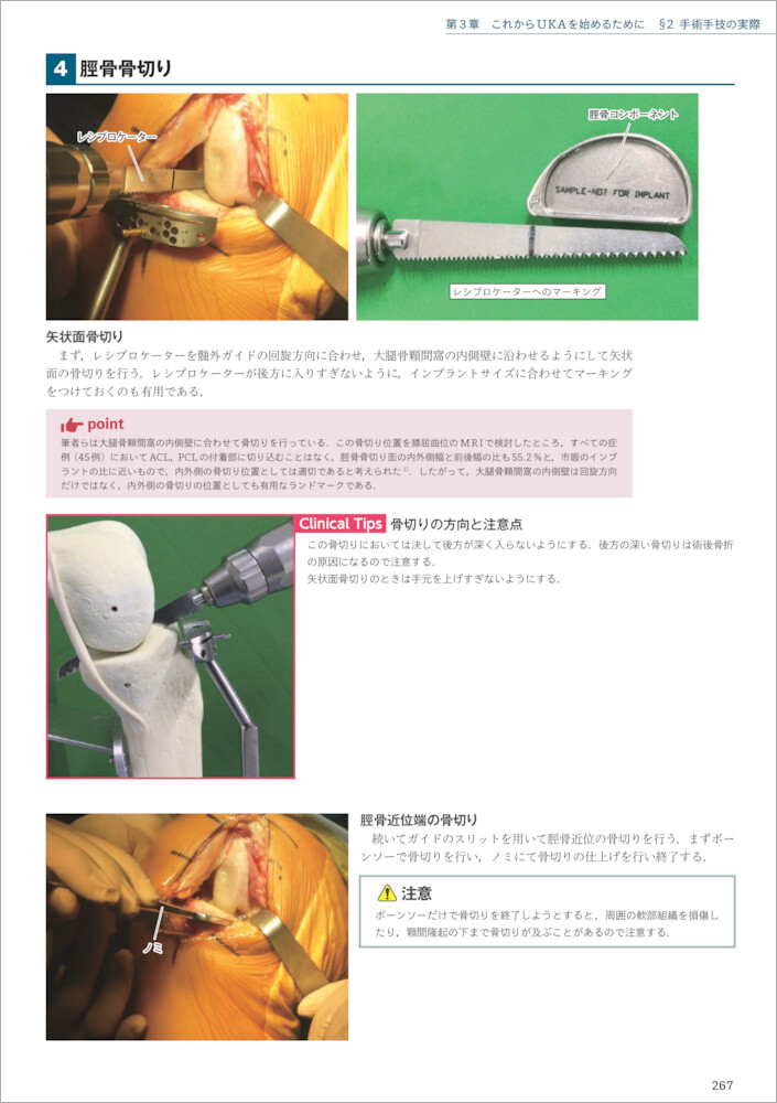 楽天ブックス: TKA・UKA 人工膝関節置換術パーフェクト - 松田 秀一 - 9784758118972 : 本