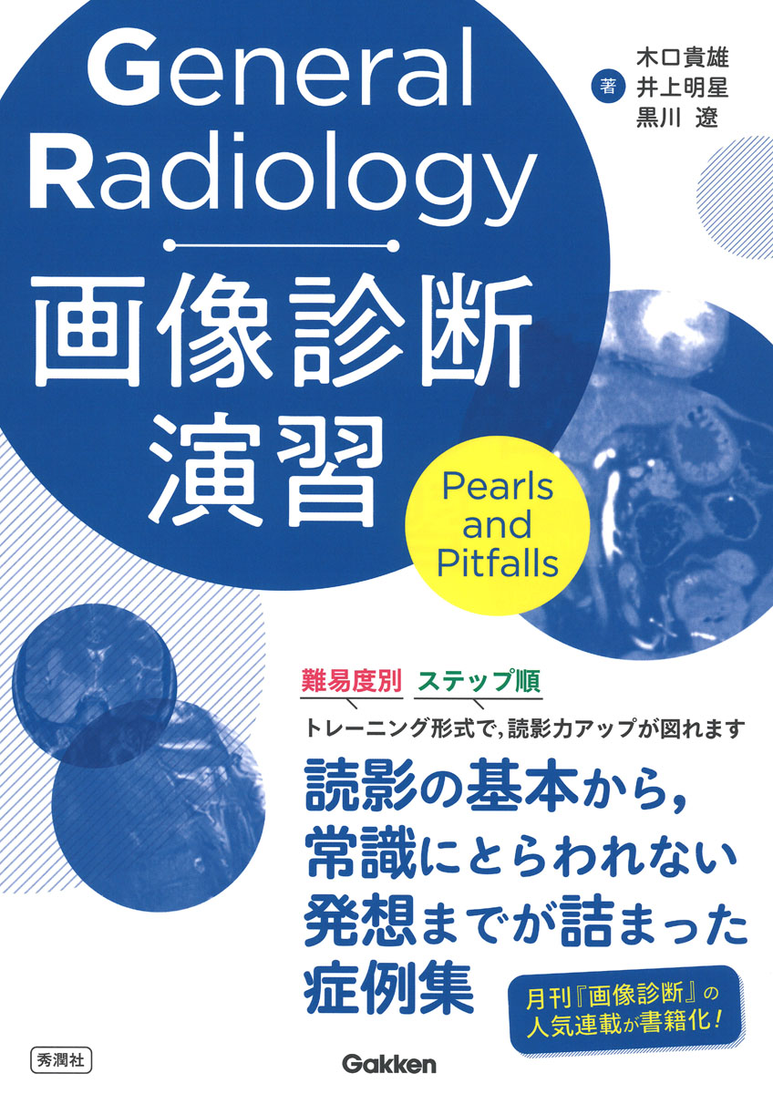 楽天ブックス: General Radiology画像診断演習 - Pearls and Pitfalls - 木口貴雄 ...