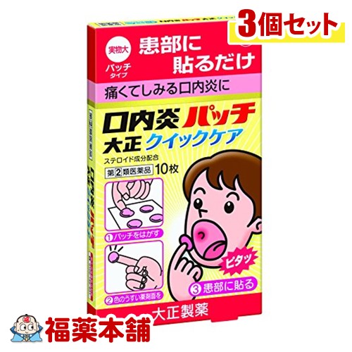 【楽天市場】【第(2)類医薬品】☆口内炎パッチ大正 クイックケア(10枚入)×3個 [ゆうパケット送料無料] 「YP20」：福薬本舗