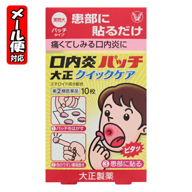 【楽天市場】\先着限定クーポン発行！1月9日(金)より／【指定第2類医薬品】【メール便09】[★self] 口内炎パッチ大正クイックケア ...