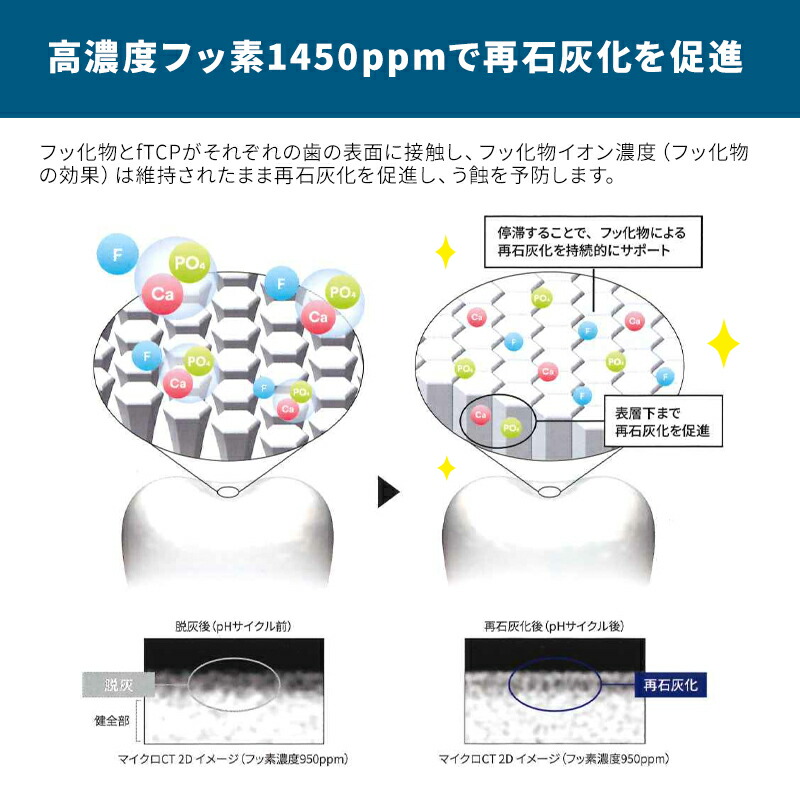 【楽天市場】3M クリンプロ 歯みがきペースト F1450 フッ素濃度1450ppm 90g × 1本 歯科専売品 【メール便OK】：お口の専門店 歯科用品専門店