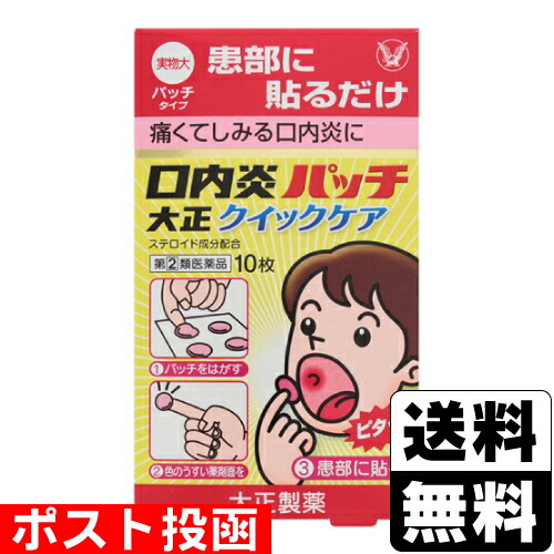 【楽天市場】【第(2)類医薬品】【セ税】 ポスト投函 [大正製薬]口内炎パッチ大正クイックケア：ドラッグストアザグザグ通販